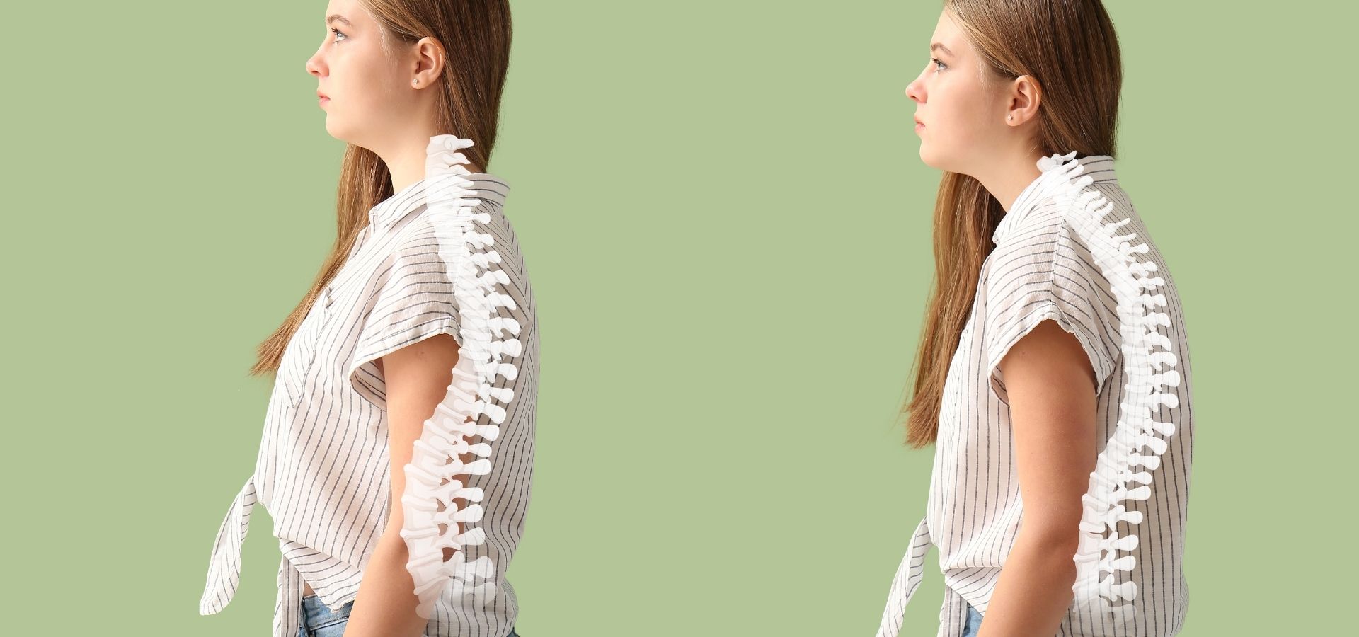 Skolyoz – Dr. Serdar Kabatas